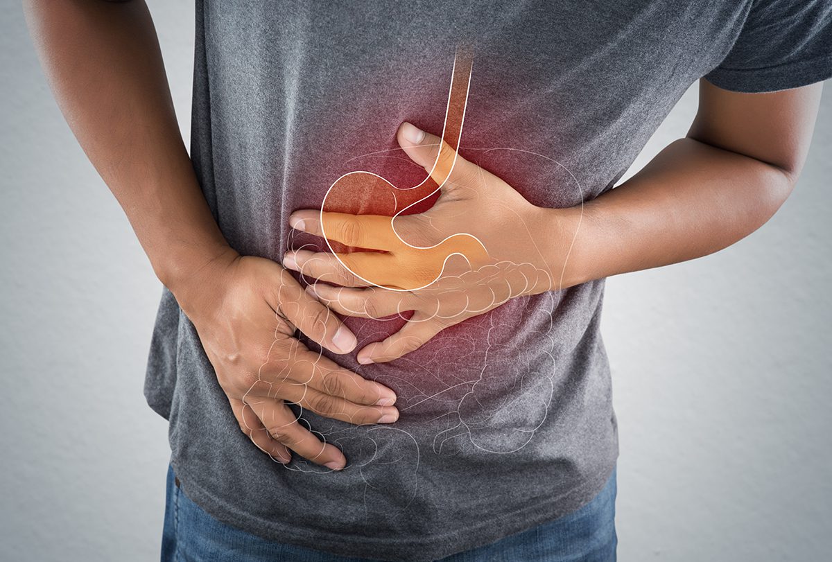 5 Best natural home remedies for acid reflux and heart burn